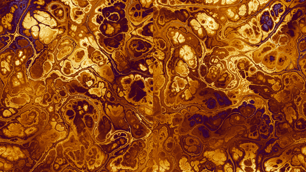 GSK and PathAI: computational pathology for precision oncology in the ...